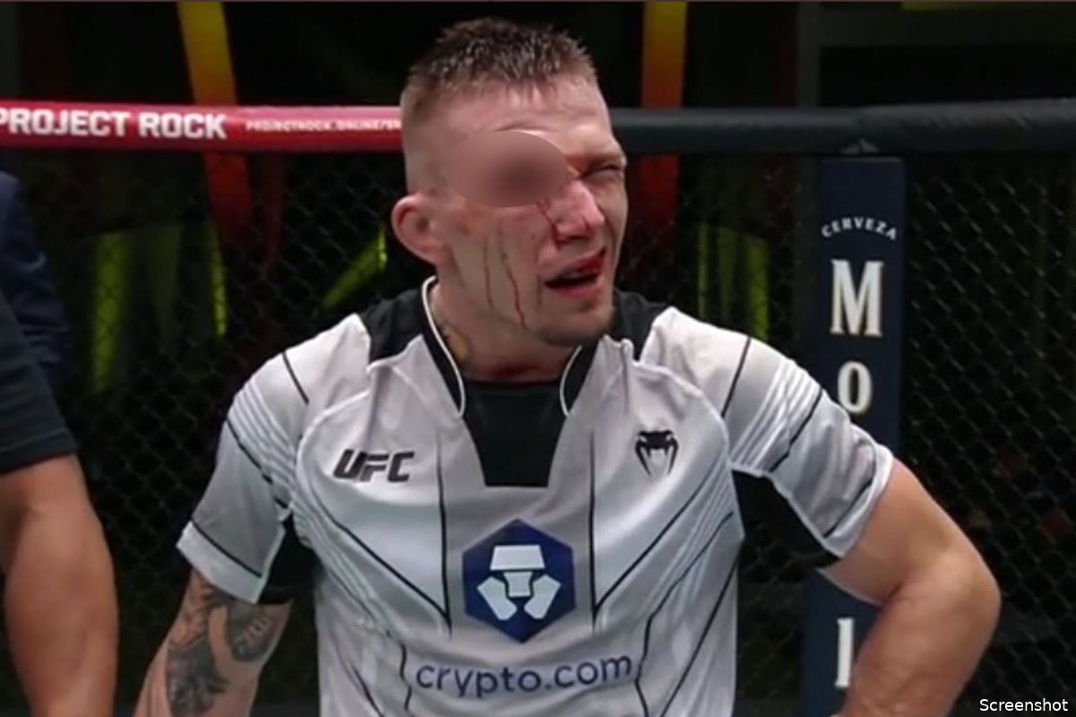Slachting! UFC gevecht gestopt vanwege heftige blessure kooivechter