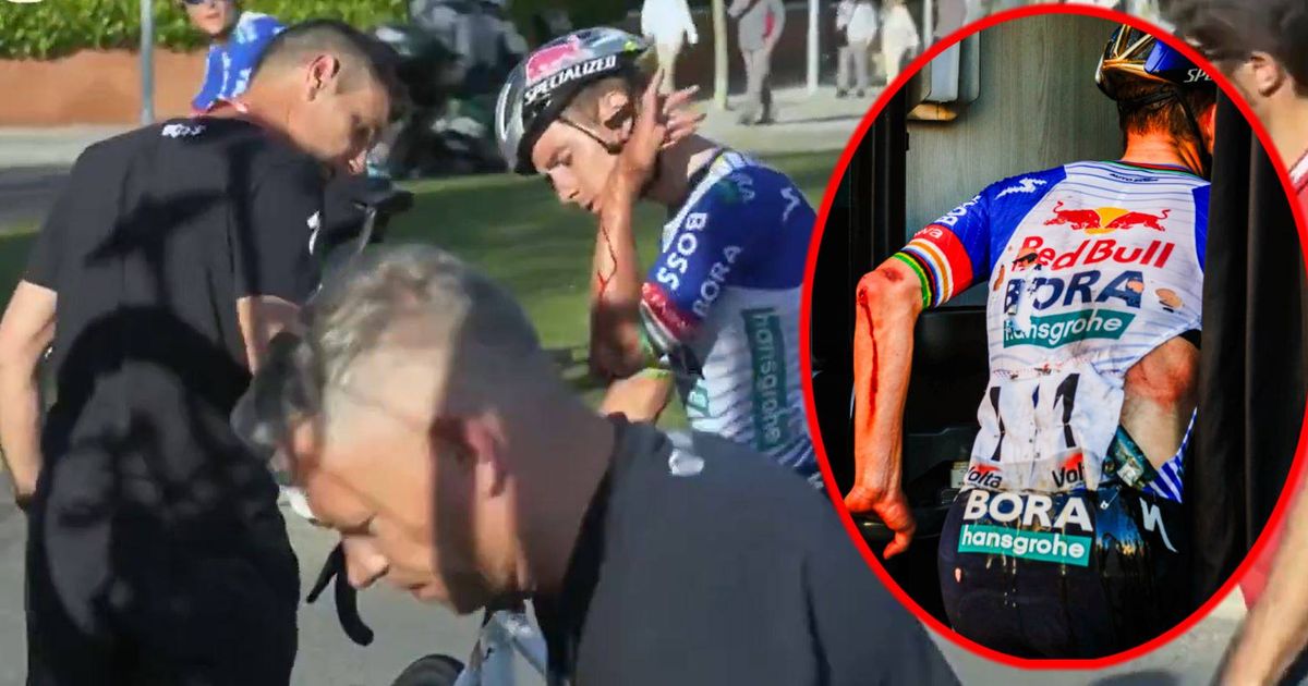 "He hit a pothole and hand slipped off his handle bars": DS explains ...