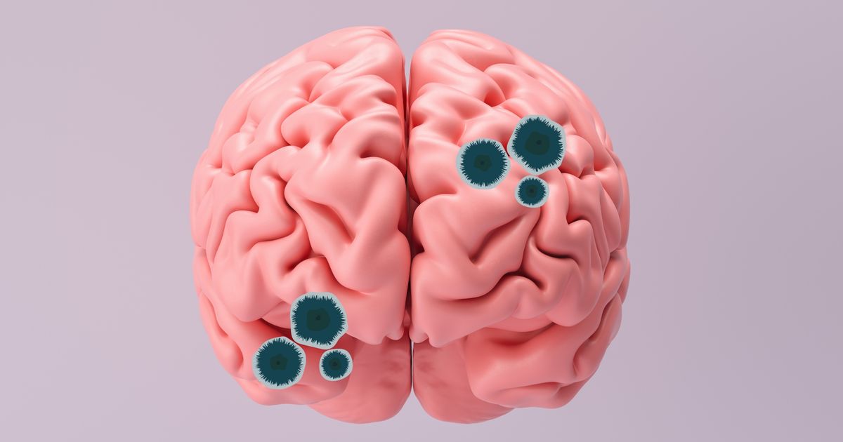 Het Oxford Woord van het jaar is Brain Rot: wat is dat?