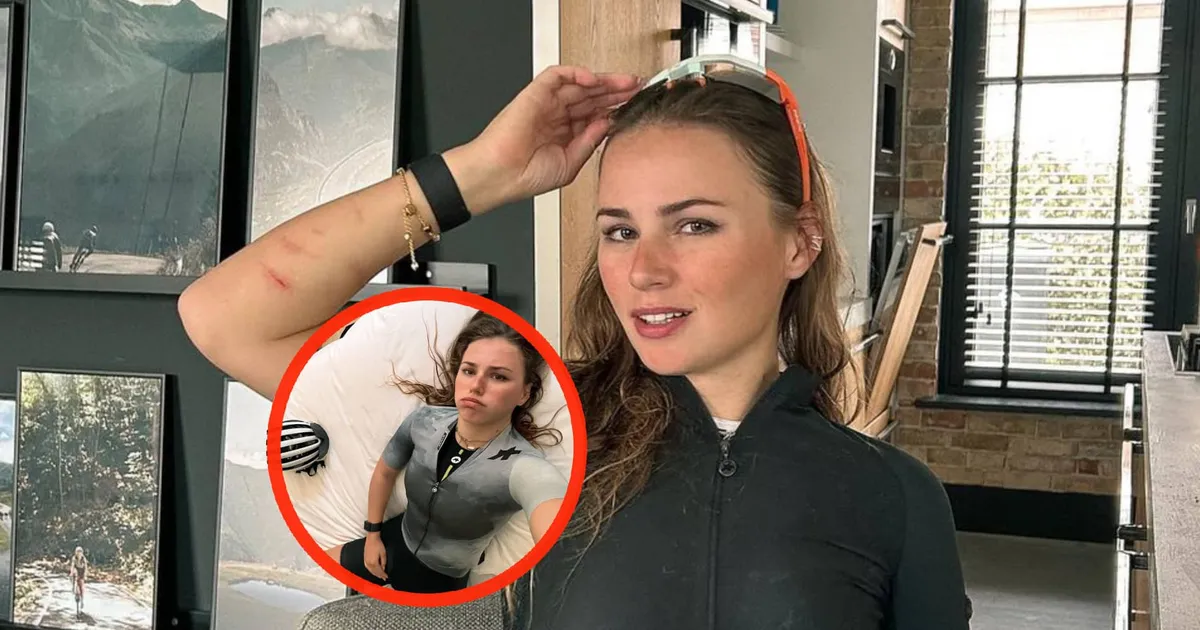 Foto: Het lijf van Puck Moonen zit onder de krassen na wilde speelsessie