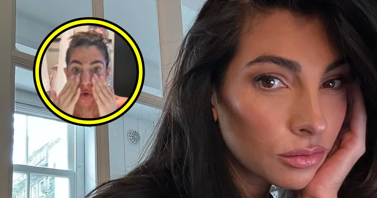 Anna Nooshin laat fans enorm schrikken met 'bloederige' video vanuit ...