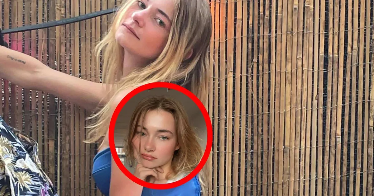 Foto: Emma Wortelboer laat nieuwe lippen zien
