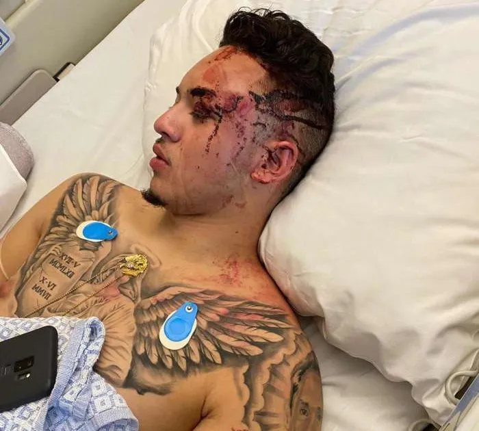 Rapper DODO reageert voor het eerst op zijn ongeluk (VIDEO)