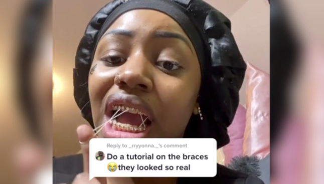Nieuwe trend: Meisjes lijmen een nep-beugel op hun tanden (VIDEO)