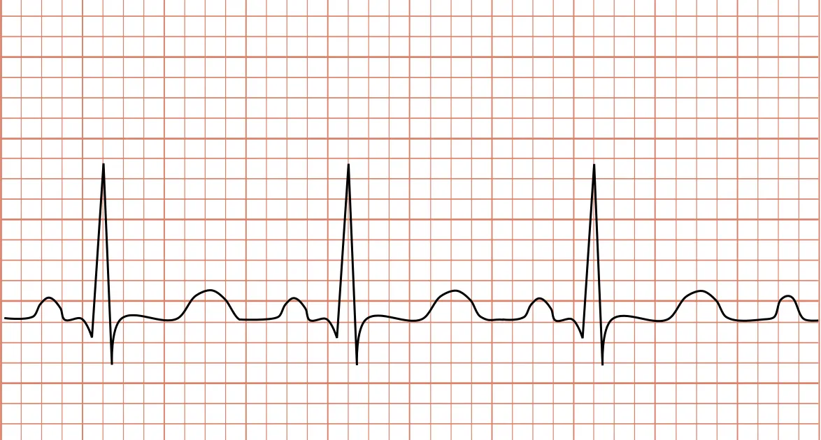 Dokter kan hartfilmpje maken met mobiel