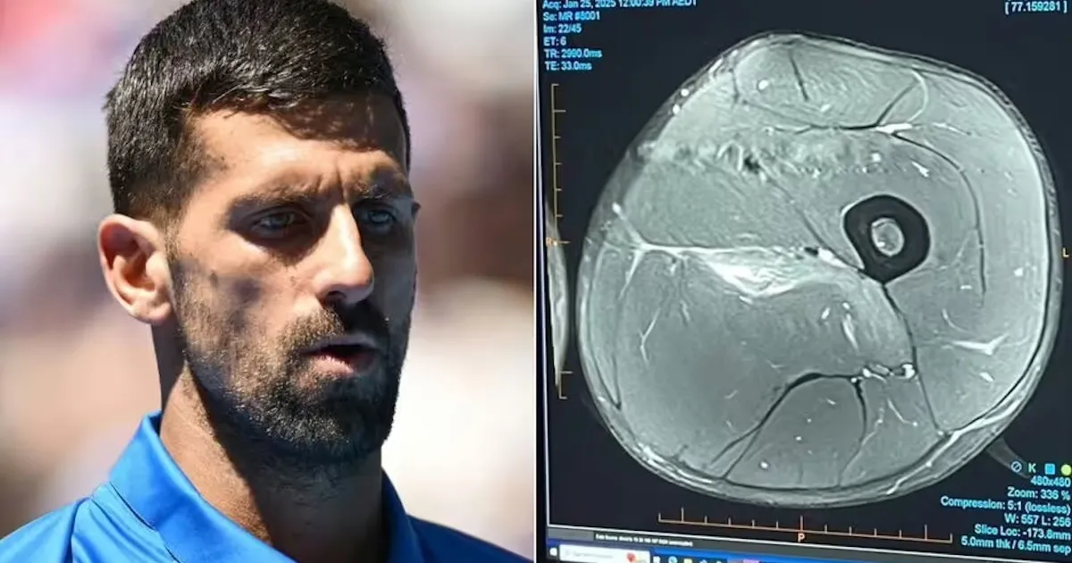 Novak Djokovic deler MR-scanning: Retter kritik mod John McEnroe og ...