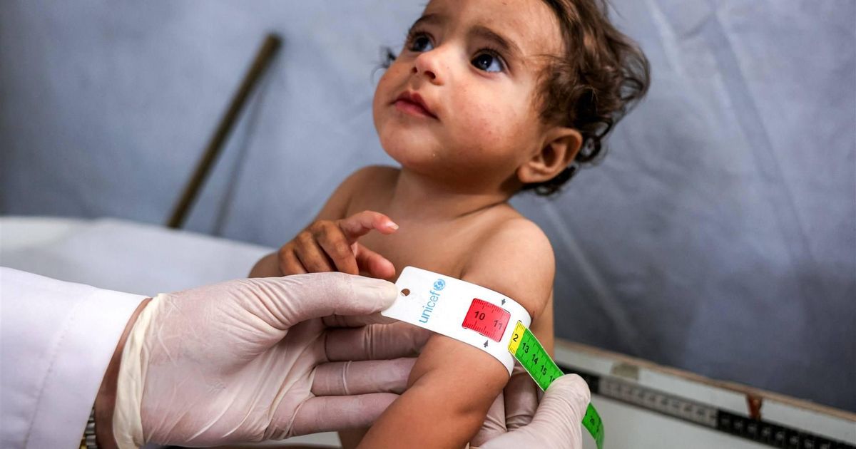 Hulporganisatie: bijna kwart van baby's in Gaza acuut ondervoed