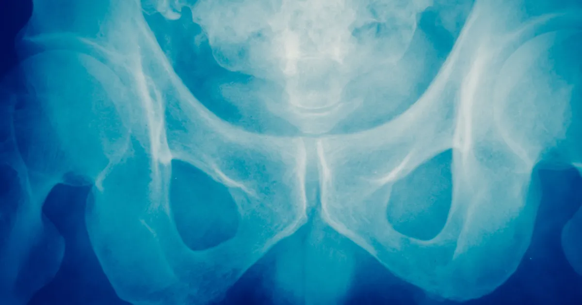 Botkanker: hier zijn de 4 belangrijkste symptomen waar je op moet ...