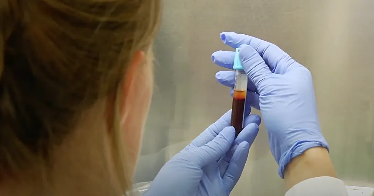 Huisartsen houden onderzoek naar chronische Q-koorts