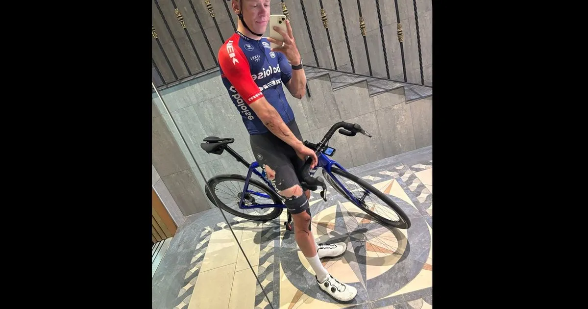 📸 Pim Ronhaar shocks Strava followers with photo of battered body ...