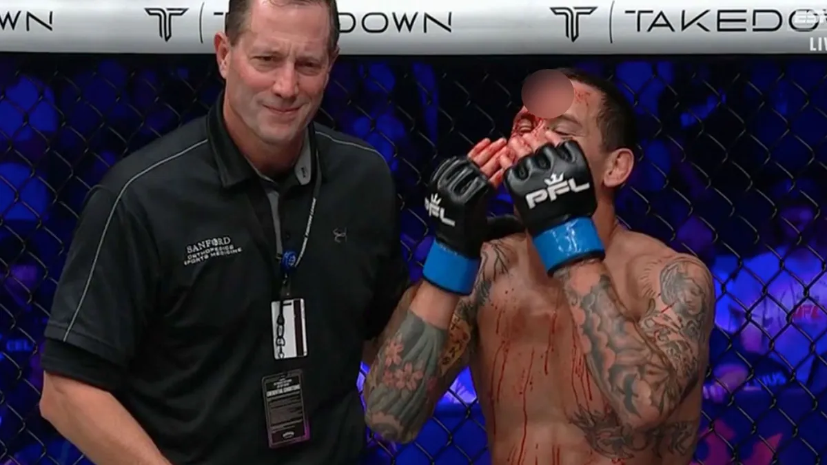 ENG! Gruwelijke blessure beëindigt MMA-gevecht op PFL 6 (video ...