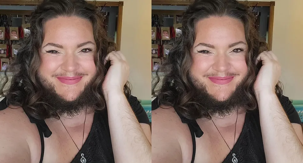 Vrouw gaat met een baard door het leven: 'Ik hou ervan'