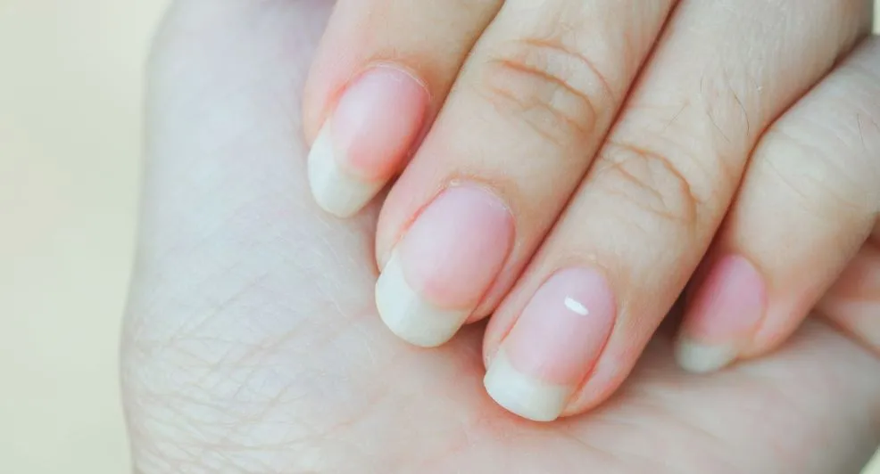 Dit is wat die witte stipjes op je nagels eigenlijk betekenen