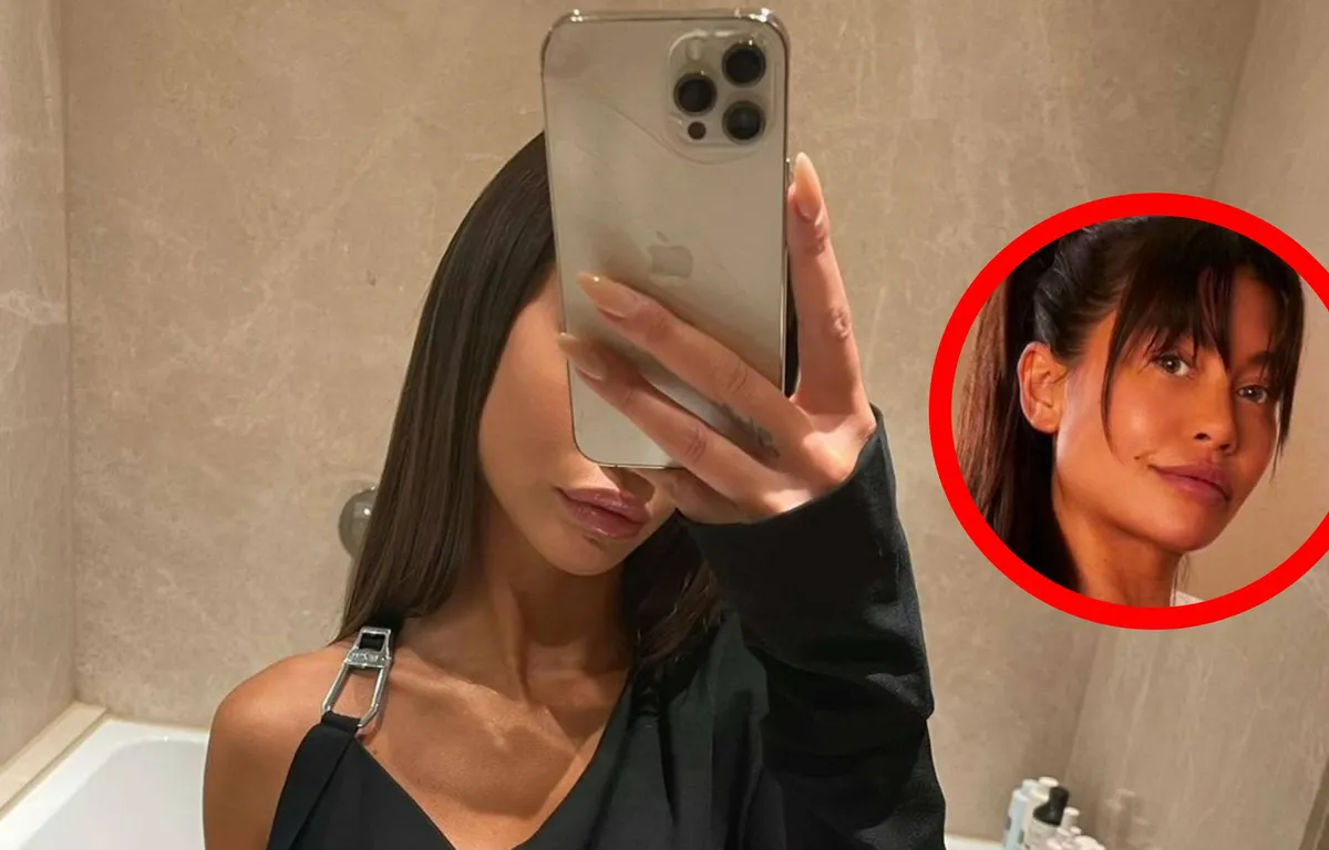 Foto: Zo ziet het gezicht van Jaimie Vaes eruit na mishandeling Lil' Kleine