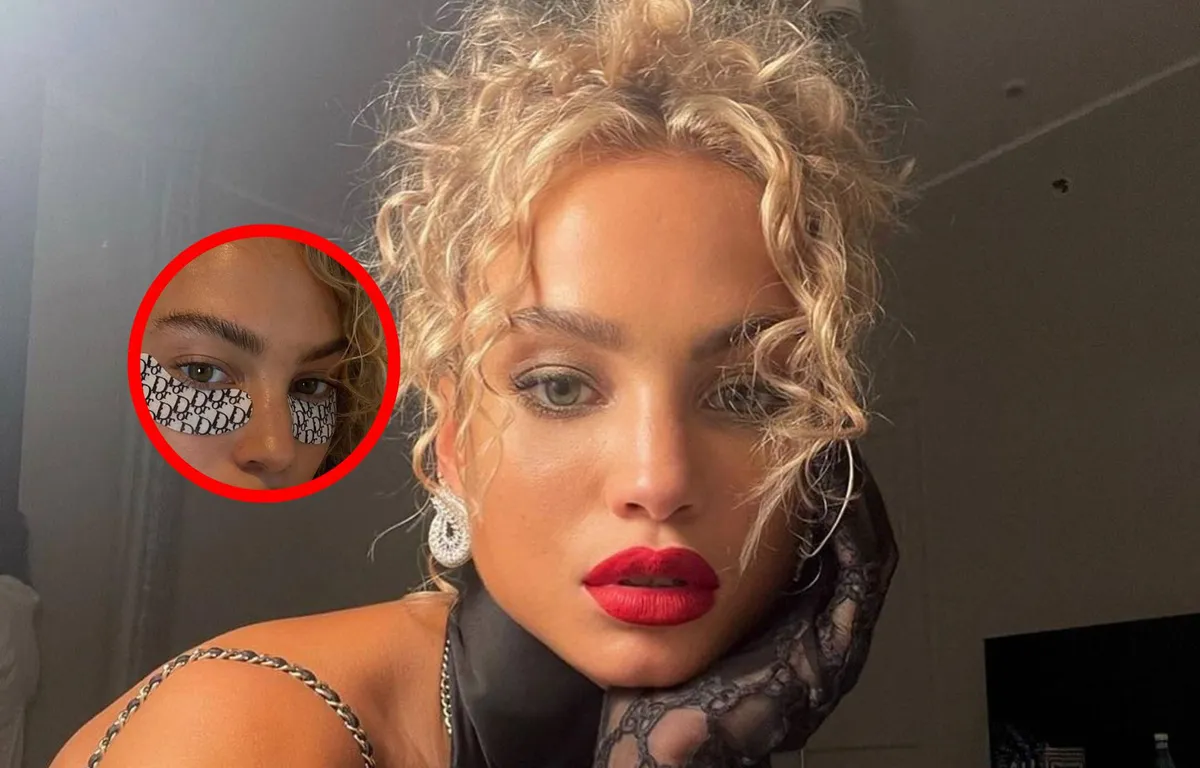 Foto: Rose Bertram laat nieuw gezicht zien na vreemde ingreep