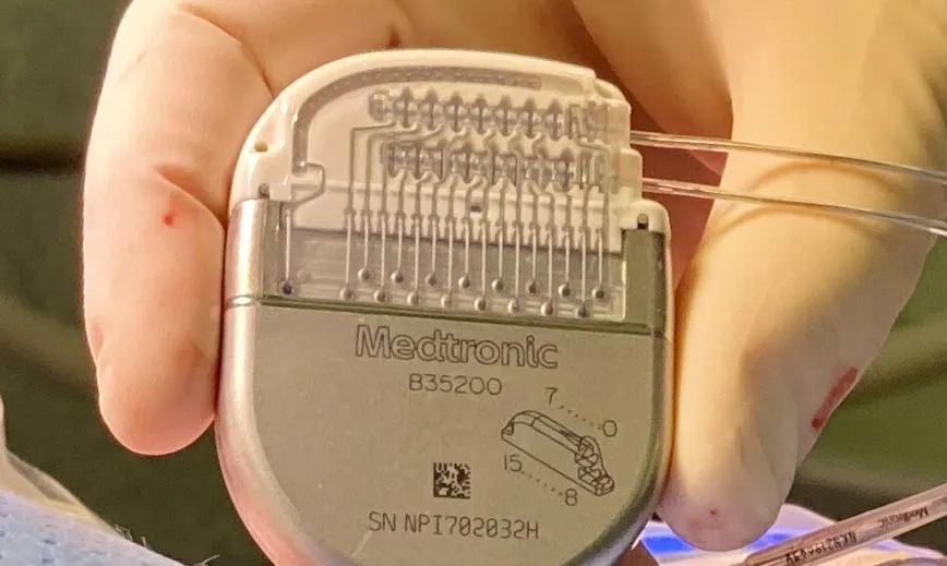 Neurostimulator meet hersensignalen Parkinson-patiënten