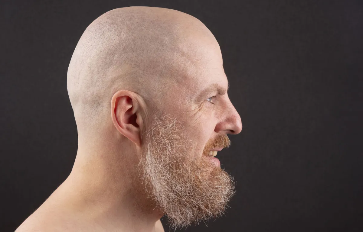 Kale mensen en mannen met baarden lopen mogelijk extra risico