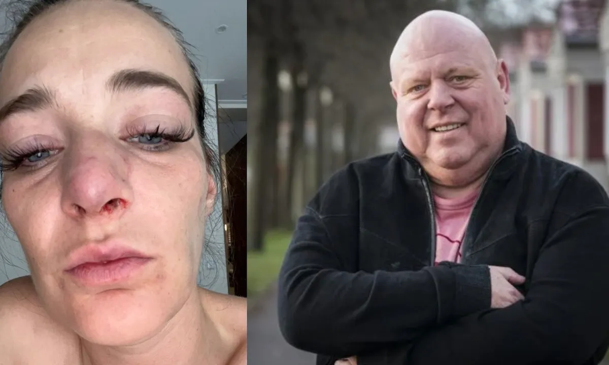 Nicol Kremers laat gruwelijke foto's van mishandeling door Peter Gillis ...