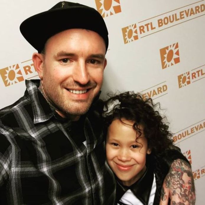 Ben Saunders deelt een heftige foto van aandoening aan gezicht