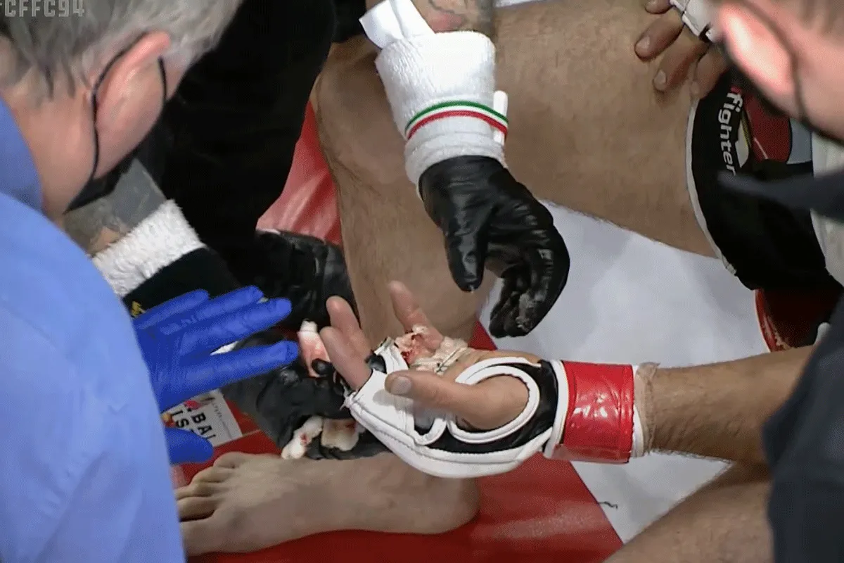 ? PANIEK: Vinger MMA-vechter scheurt compleet af in wedstrijd ...