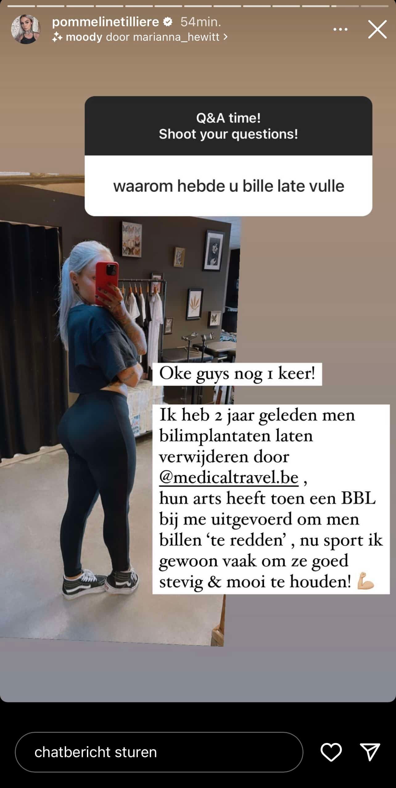‘Temptation’-Pommeline maakt een einde aan de roddels over haar poep ...