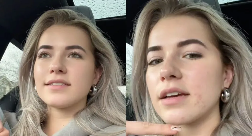 Jade Anna laat via TikTok haar 'echte huid' zonder filter zien